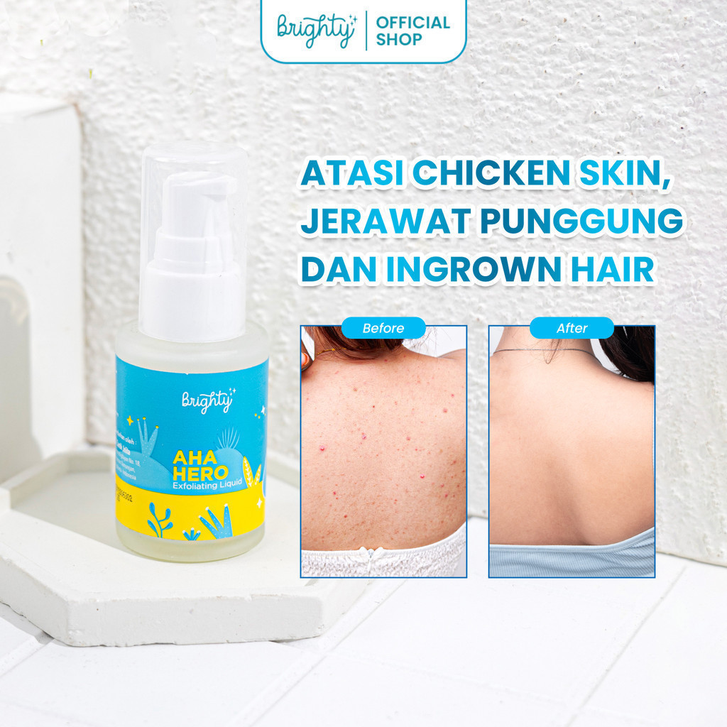 Brighty Aha Hero Exfoliating Liquid (Lightning Serum/Back Acne/Back ...