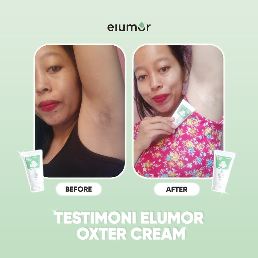 Elumor Oxter Cream New Formula 30g Underarm and Groin Whitening Cream ...