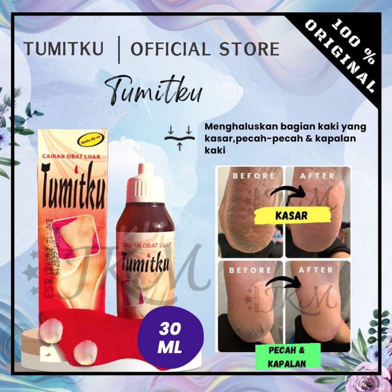 Tumitku ORIGINAL MEDICINE FOR SHREDDED FEET | Shopee Malaysia