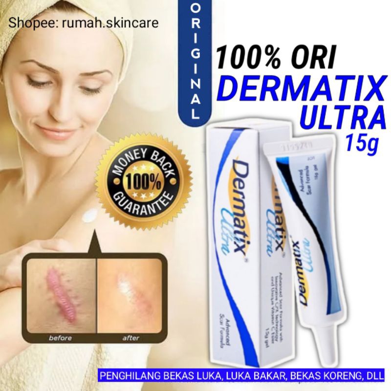 Dermatix Ultra Gel 15g SCAR Removal/Keloid ANTI SCAR Stretchmark 15gram | Shopee Malaysia