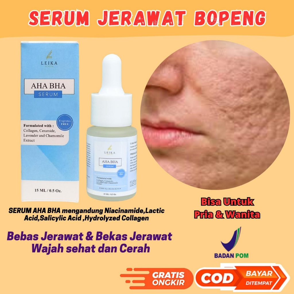 HITAM Powerful Permanent acne serum Original Bpom acne Remover acne ...