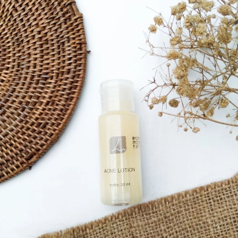 Acne Lotion Larissa Original/W Larissa Acne Medicine | Shopee Malaysia