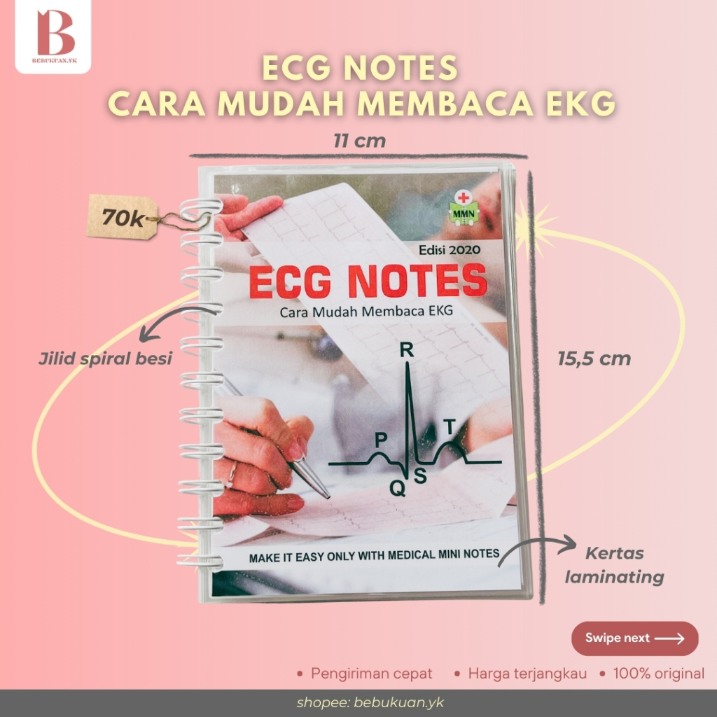 Ecg Notes MMN | Mmn Electrocardiography Book | Medical Mini Notes ...