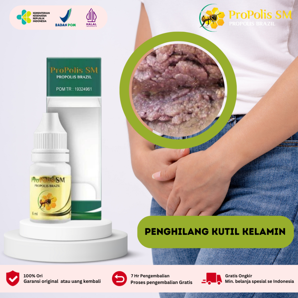 Medicine For Genital Warts Condiloma And Papilloma On The Neck Of The ...