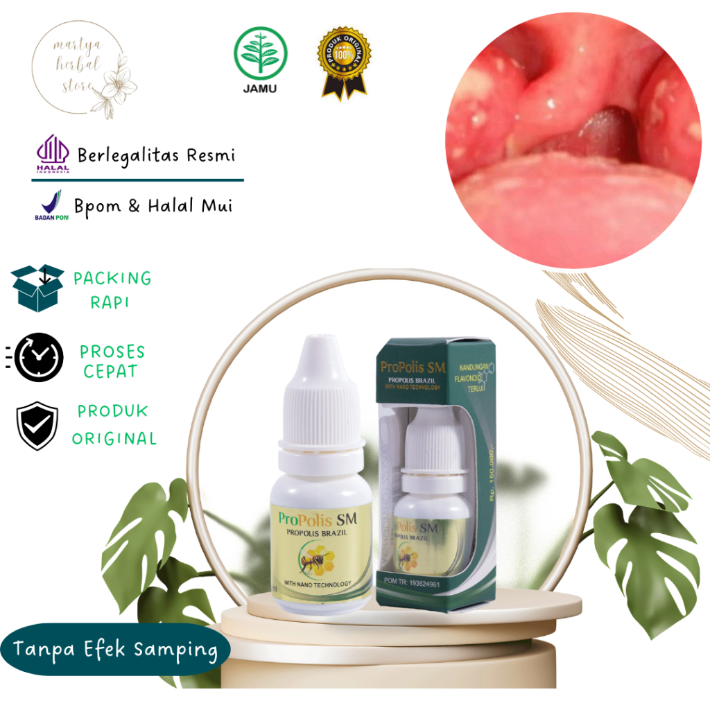 Herbal Medicines For Tonsils Of Sore Throat Medicines When Swallowing ...