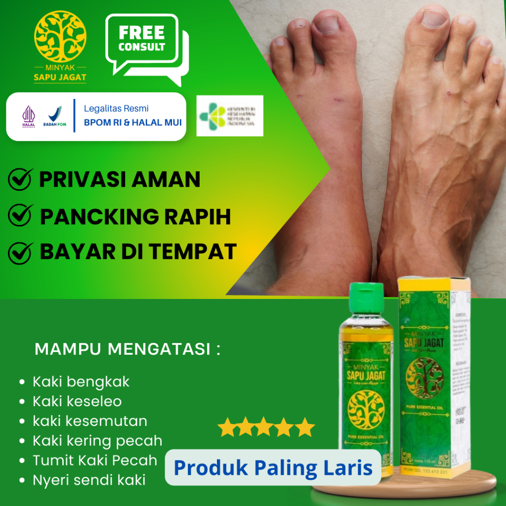 Foot Oil Swelling Tingling Tingling Heel Cracked Dry And Foot Joint ...