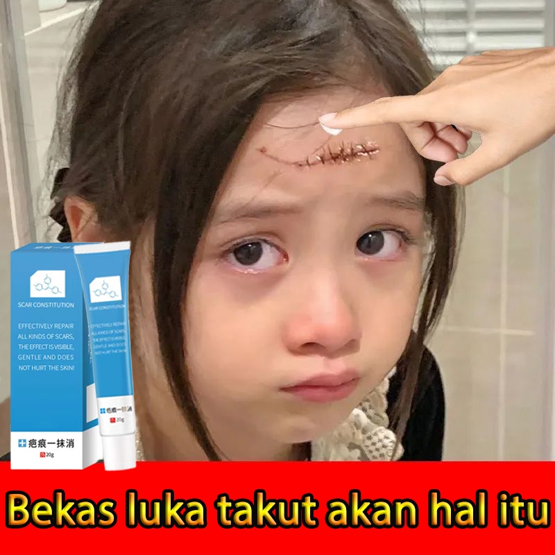 HITAM Scar Removal Acne Spots Smallpox Allergies Itching Mosquito Bites ...