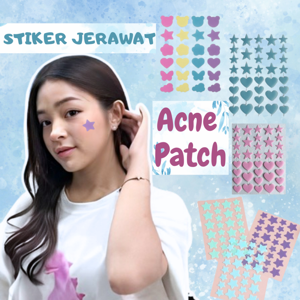 (Complete) Patch Pimple Sticker/Acne Sticker Removes Removing Acne ...