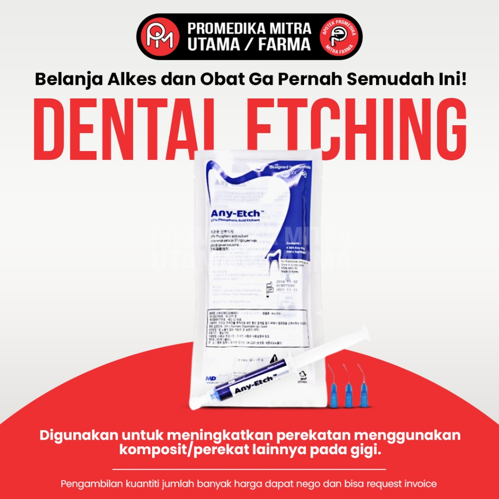 Dental Etching ANYETCH Any Etch Dental Etching Gel | Shopee Malaysia