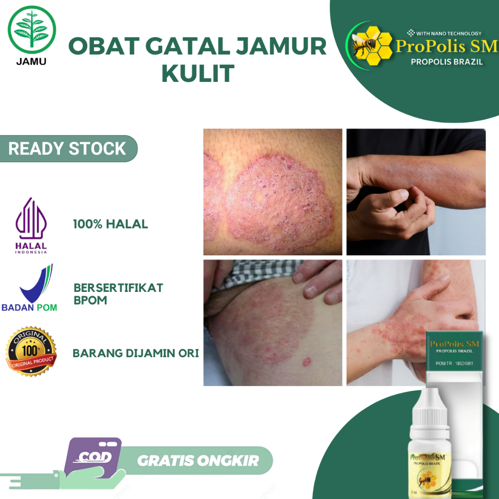 Medicine For Itching Skin Fungus Ringworm Panu Candidiasis Eczema ...