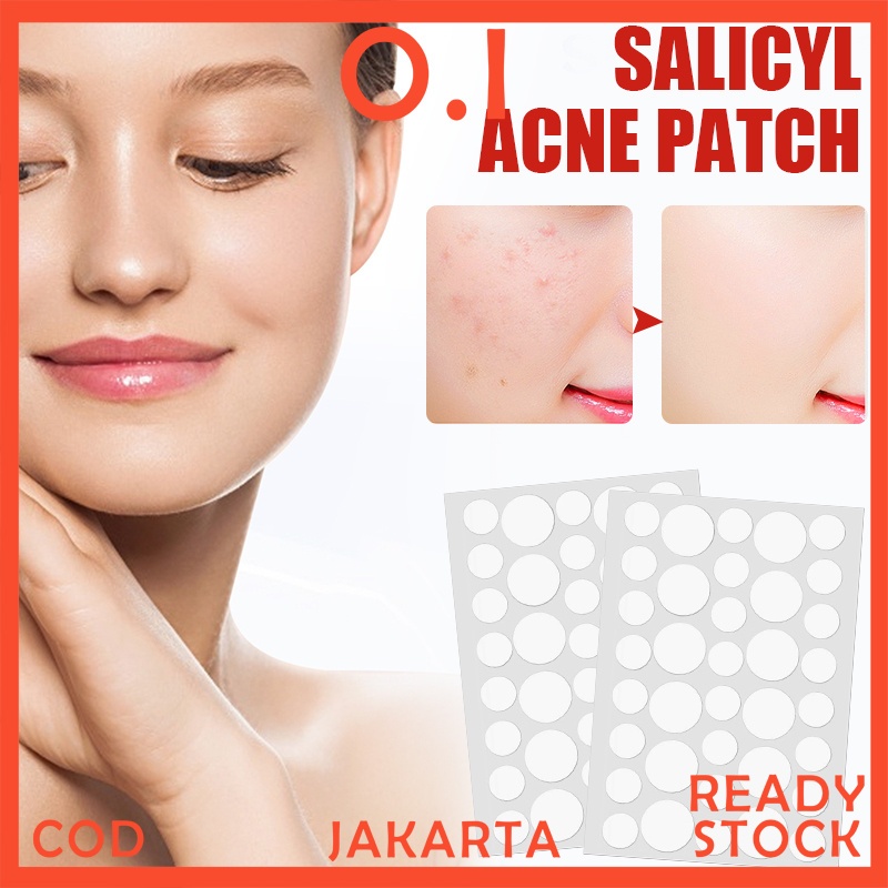36Pcs Acne Stickers Transparent Invisible Acne Pimple Patch Acne ...