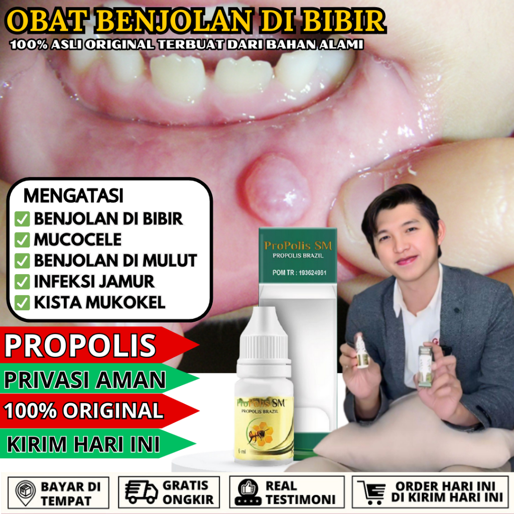 PUTIH Medicine Drops White Spots On The Tongue Of The Mouth Smells ...