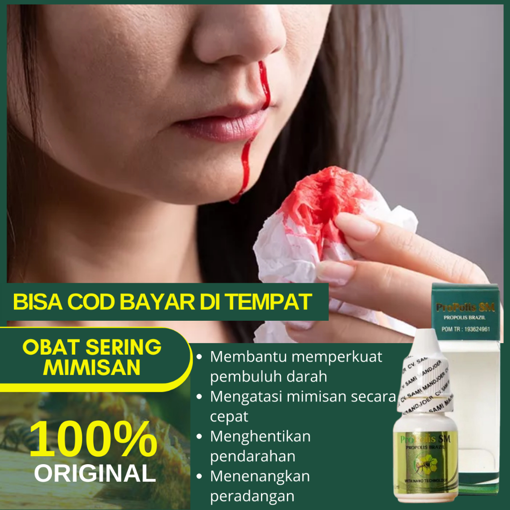 Medication For Frequent Nosebleeds, Stop Nose, Nose Blood Out, Nose ...