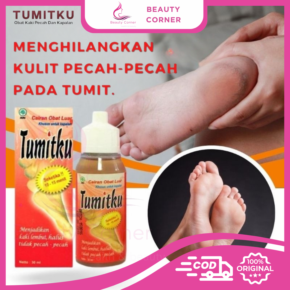 My Heel Is Herbal Medicine To Overcome Cracked Legs And Calluses ...