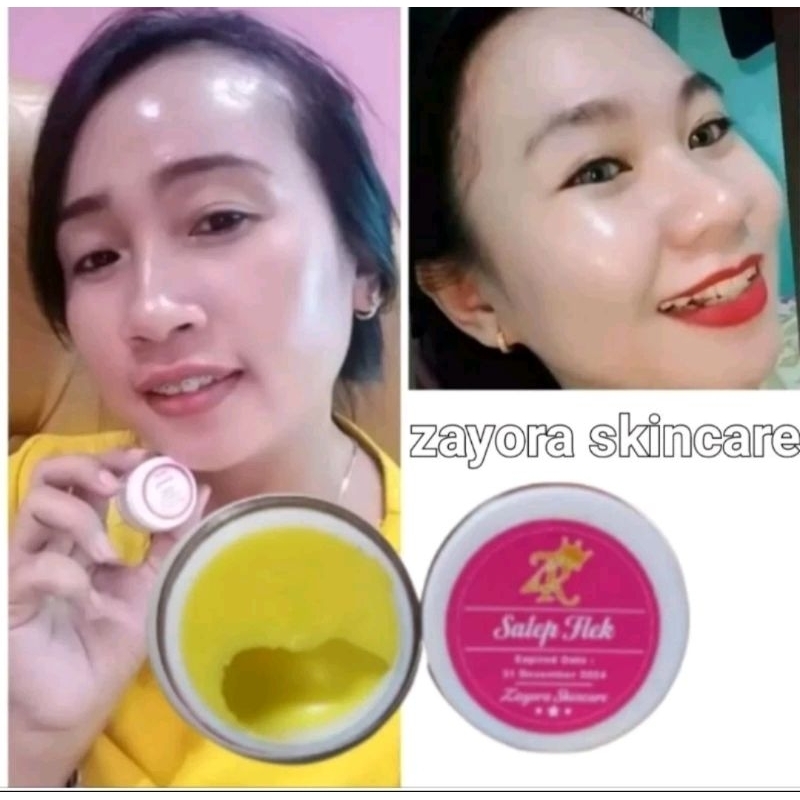 !! Zayora small spot ointment | Shopee Malaysia