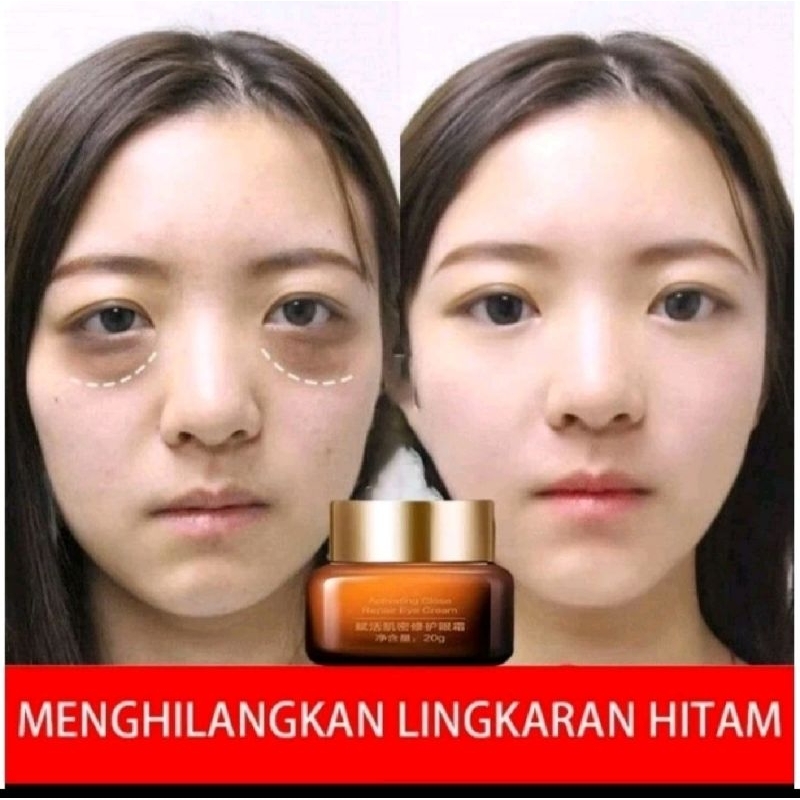 MATA Eye SERUM REPAIR EYE CREAM 20G Remove PANDA EYE Bags | Shopee Malaysia