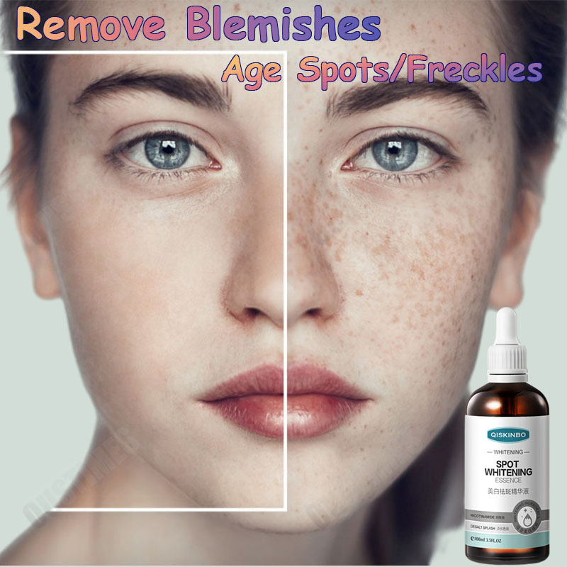 HITAM 100g DARK SPOT TREATMENT SERUM/Moisturizing Shrinking Anti Aging ...