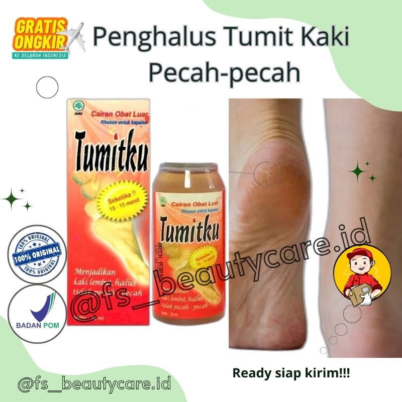 My Heel Is original Powerful original Broken Foot Liquid Medicine For ...