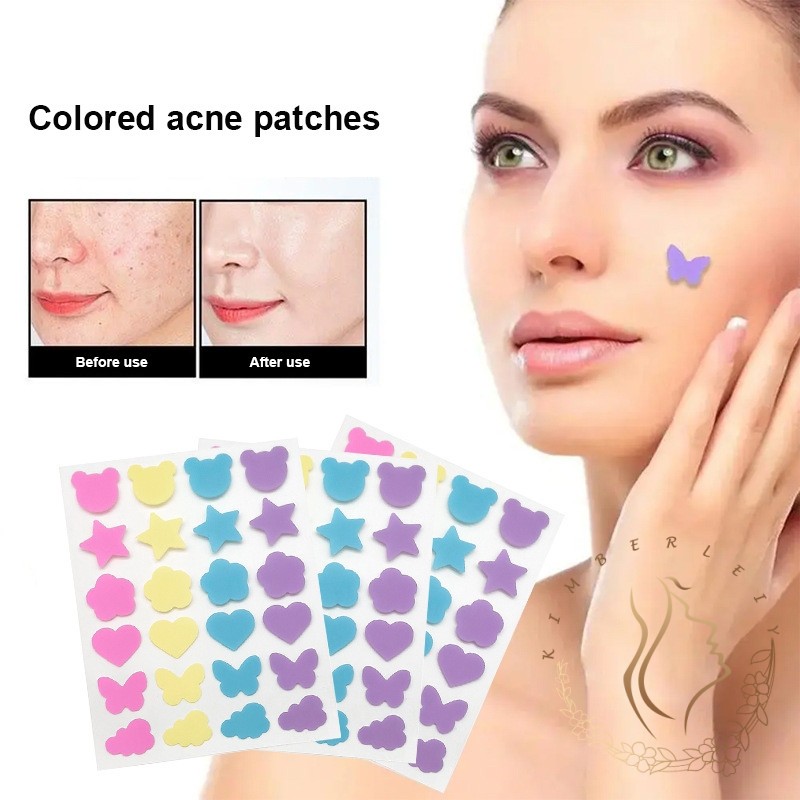 (20/24 Pcs) Pimple Patch / Acne Sticker removes Acne filling | Shopee ...