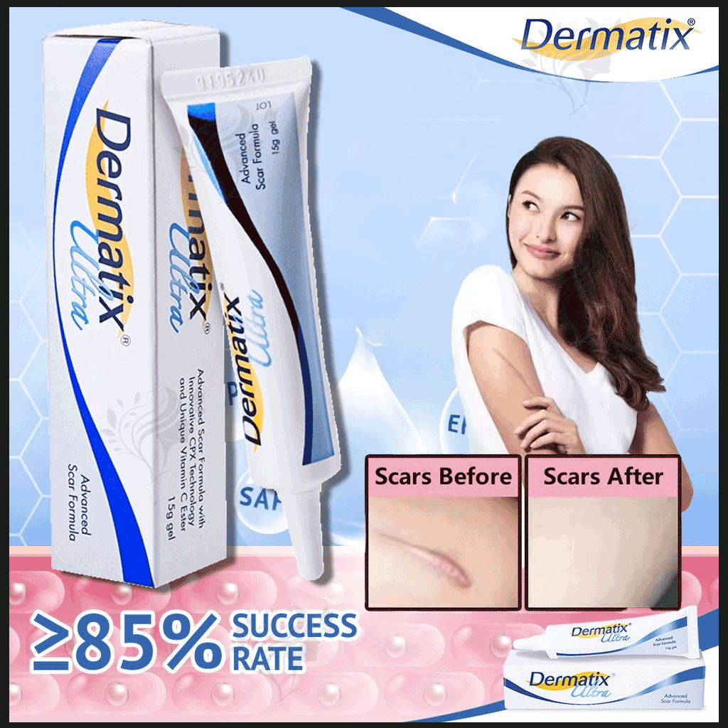 Dermatix Ultra Dark Scars & Keloid Fading Gel 15gr | Shopee Malaysia