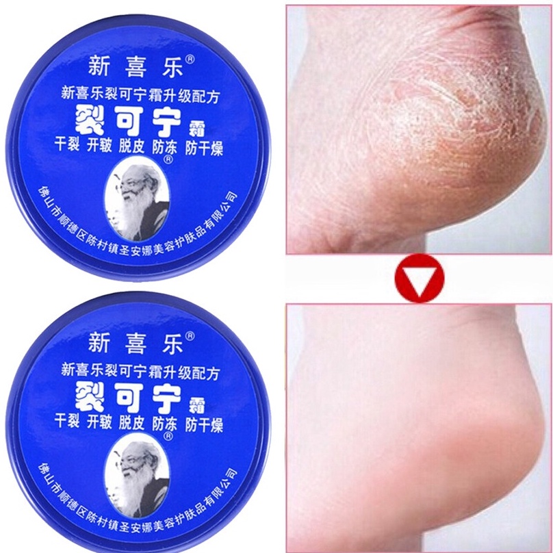 Art O76C Foot Cream Hand Heel Calluses Dry Feet Cracked Skin Smoothing ...