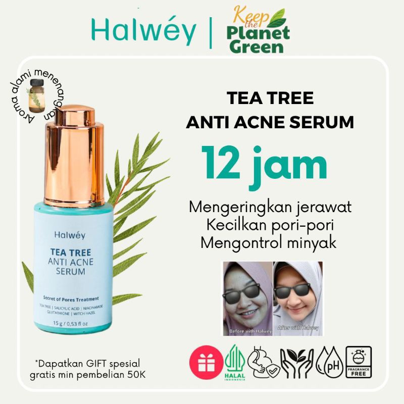Anti Acne Herbs Serum Halwey, 15gr | Shopee Malaysia