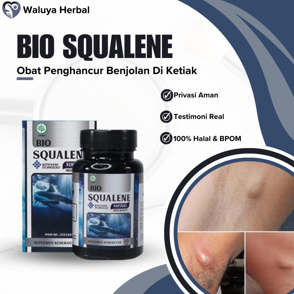 Medicine for Lumps in the Armpits Neck Hands Feet Back Lipoma Lumps ...