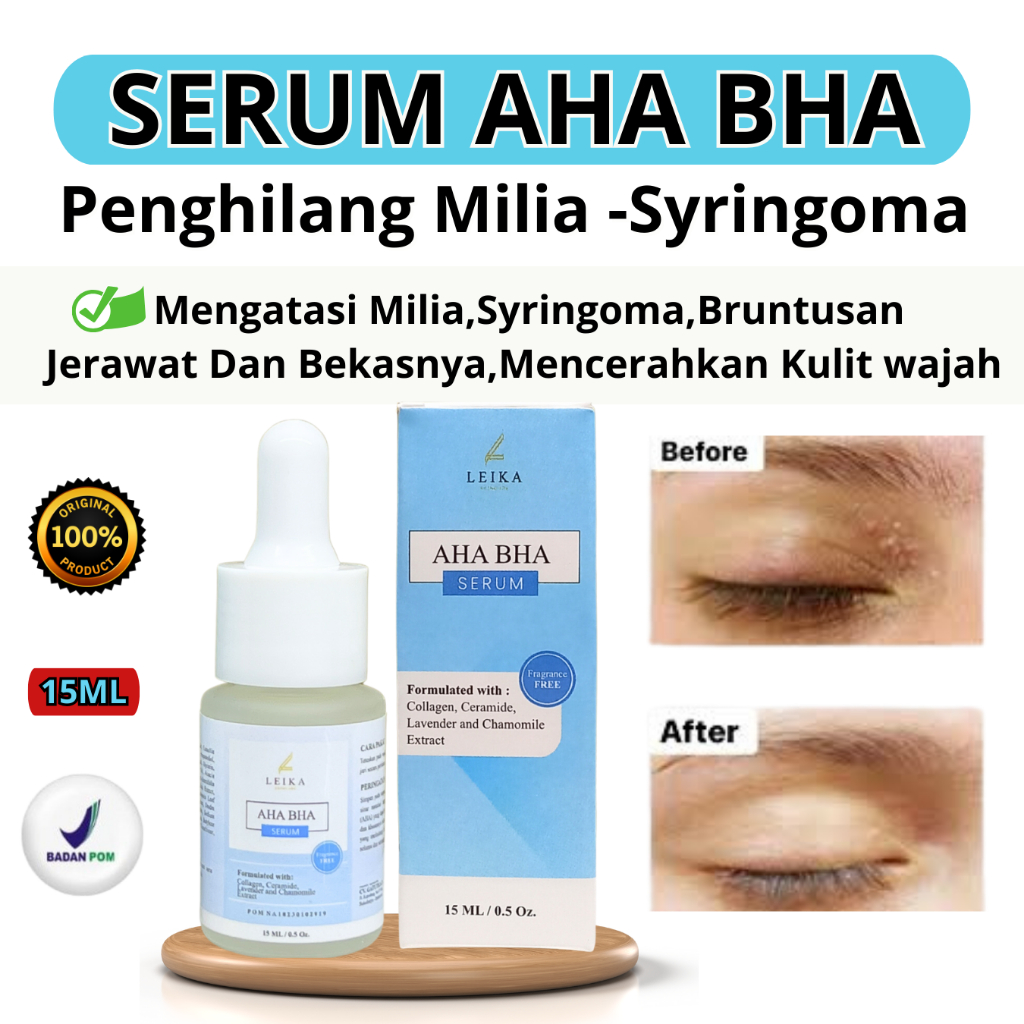 MATA Powerful Milia Removal Bpom serum AHA BHA Milia Original serum ...