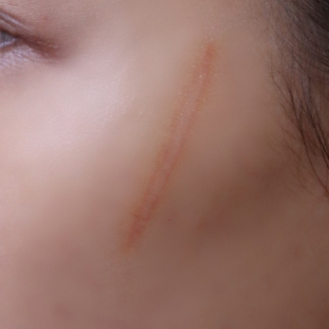 [READY] TEMPORARY TATO Healed Scar | TATO FOR PRANK | TATO FOR ...