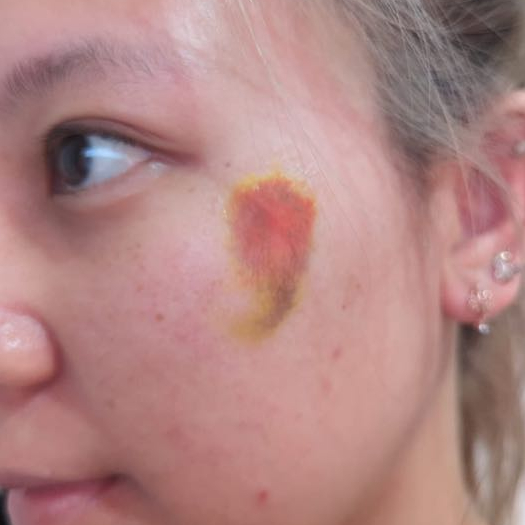 MERAH [Small Healing Bruise 10] RED LEBAM WOUNDS | False Swollen WOUNDS ...