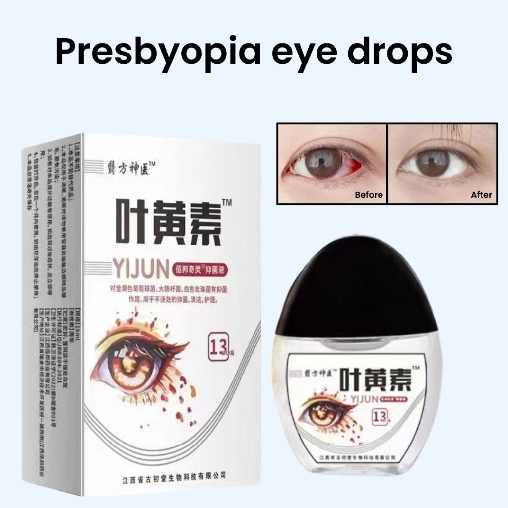 MERAH MATA Yijun Eye Drops - Dry Eye Pain Red Eyes Blurred Eyes - VP054 ...