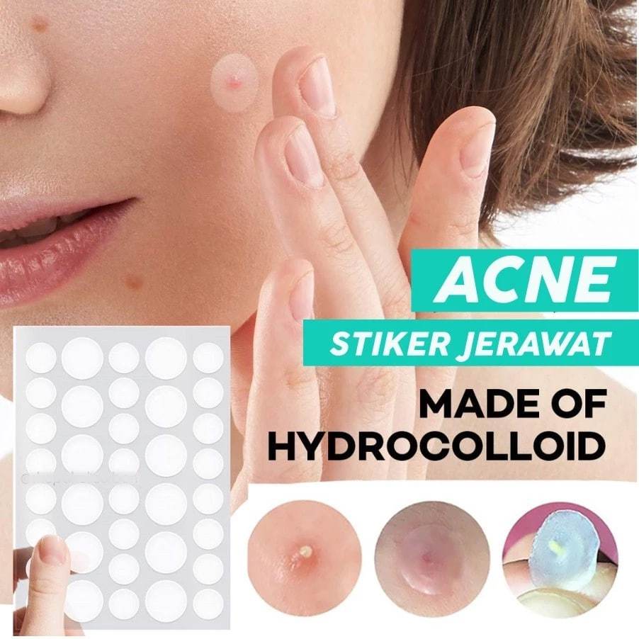 PUTIH Acne Pimple Patch Plain White Stickers 36 PCS | Shopee Malaysia