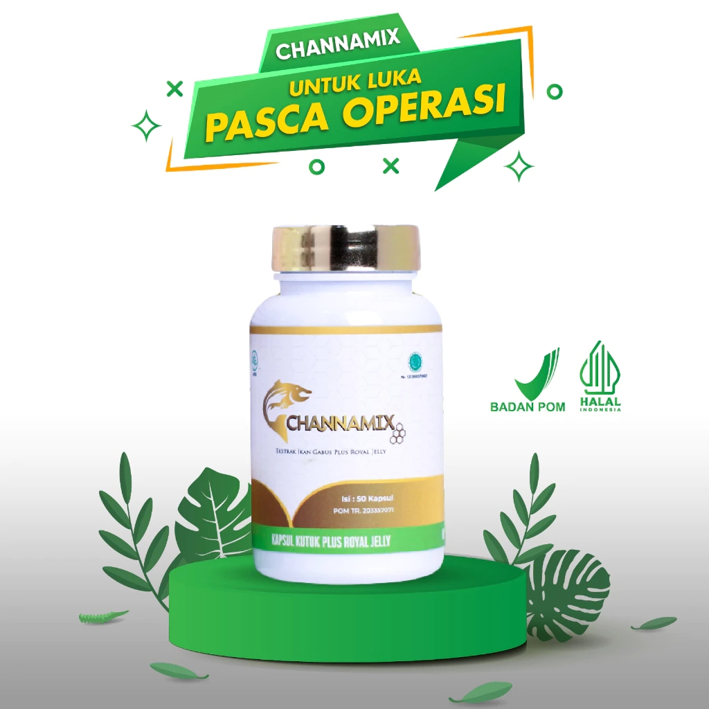 Channamix Cursed Fish Capsules Accelerate the Wound Healing Process ...