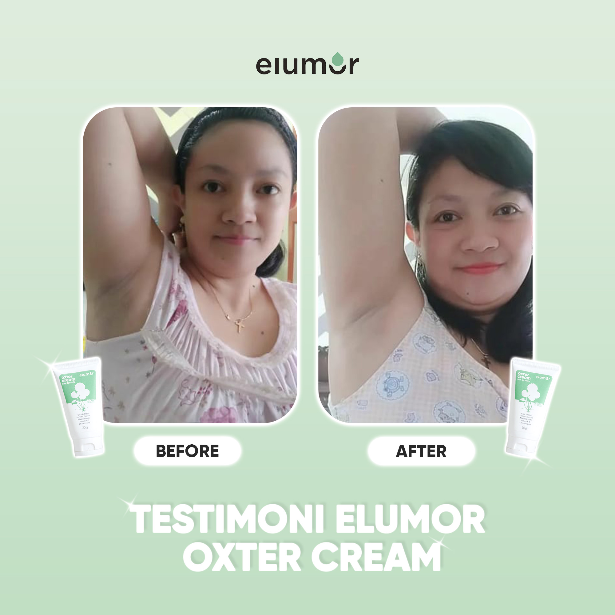 Elumor Oxter Cream New Formula 30 Gr - Groin Whitening And Miss V ...
