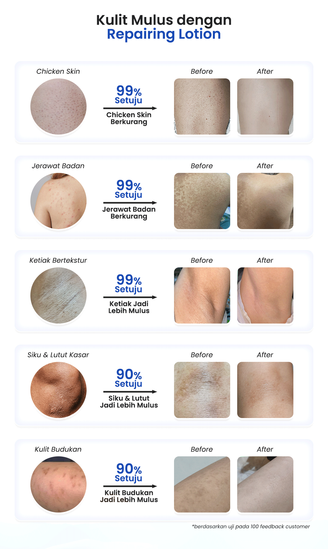 Rintik Skincare - Travel Size No Bump Lotion/ Body Lotion for Pimples, Chicken skin, Body Acne ...