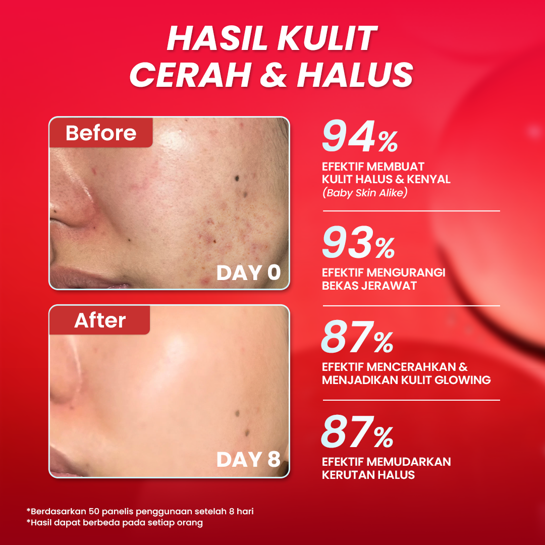 Hanasui Advance Retinol Serum - Anti Aging Serum for Fine Wrinkles ...