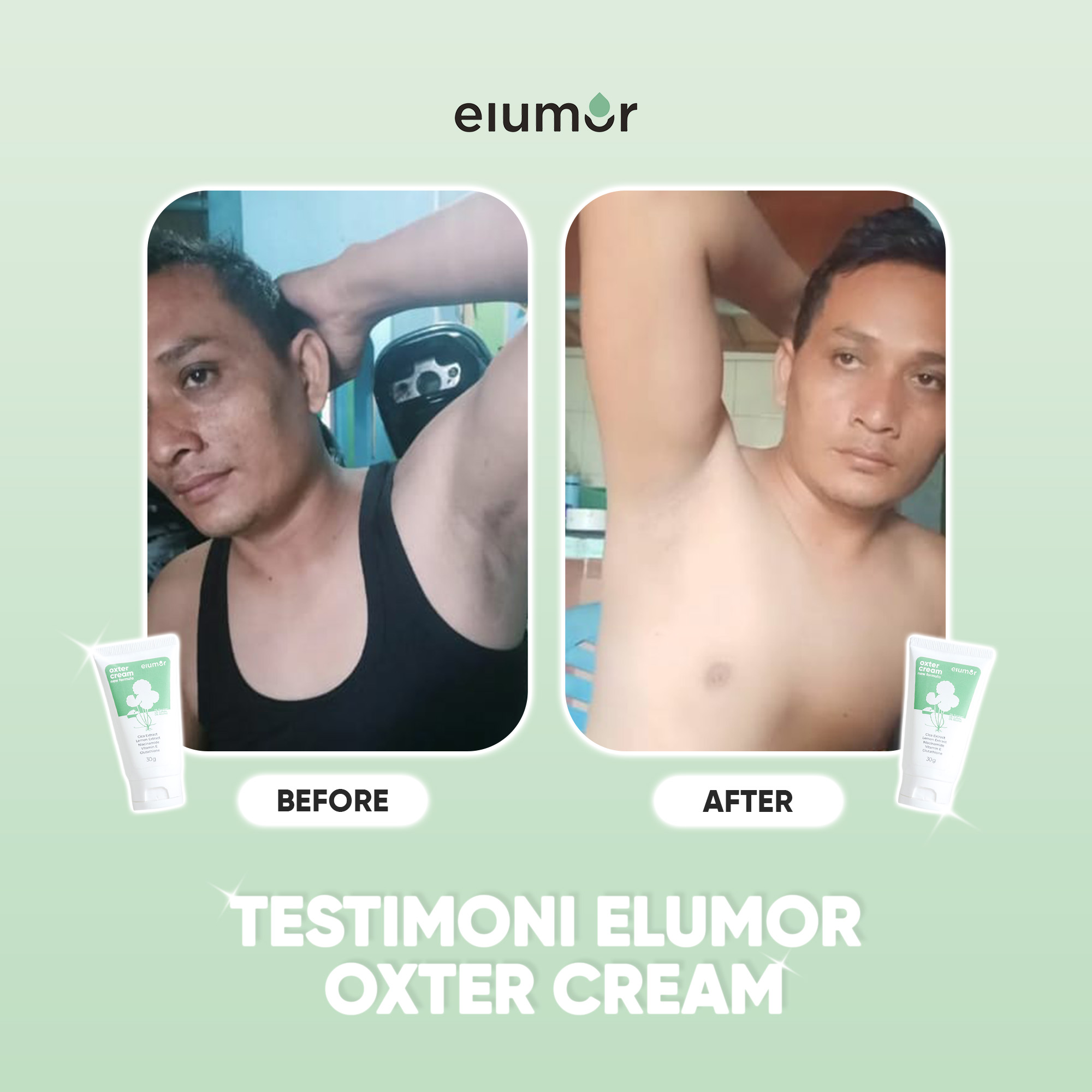 Elumor Oxter Cream New Formula 30 Gr - Groin Whitening And Miss V ...