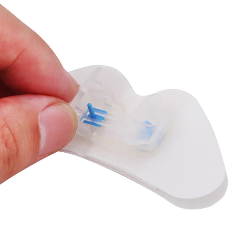 Picc catheter fixation device body surface catheter fixation device ...