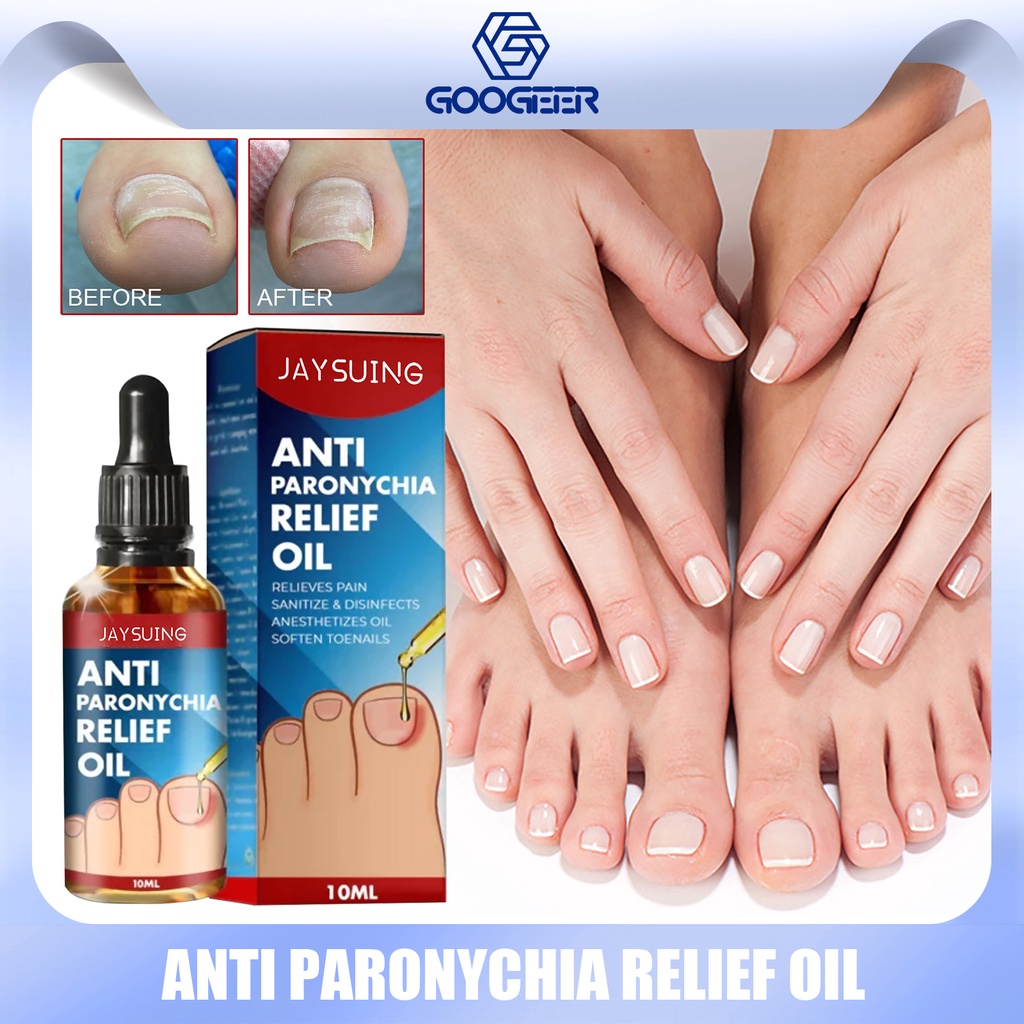 Jaysuing Anti Paronychia Relief Oil Reduce Ingrown Toenails Drops Corrector Repair Liquid Anti ...