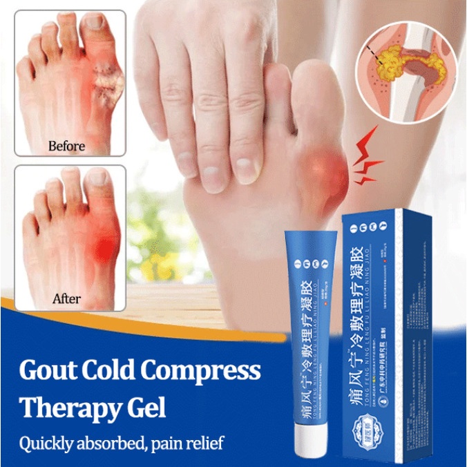 Gout cold compress physiotherapy gel、Stiff hands and legs gout cold ...