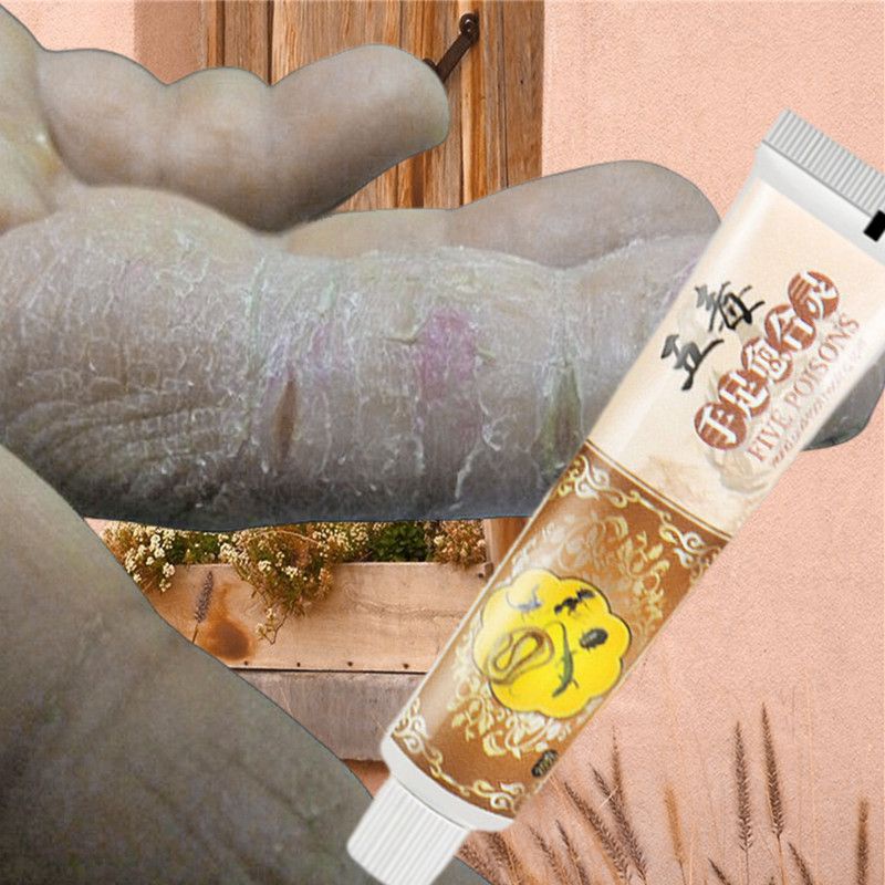 Finger cracks, hangnails, nail edge cracks, fingertip cracks, go Finger ...