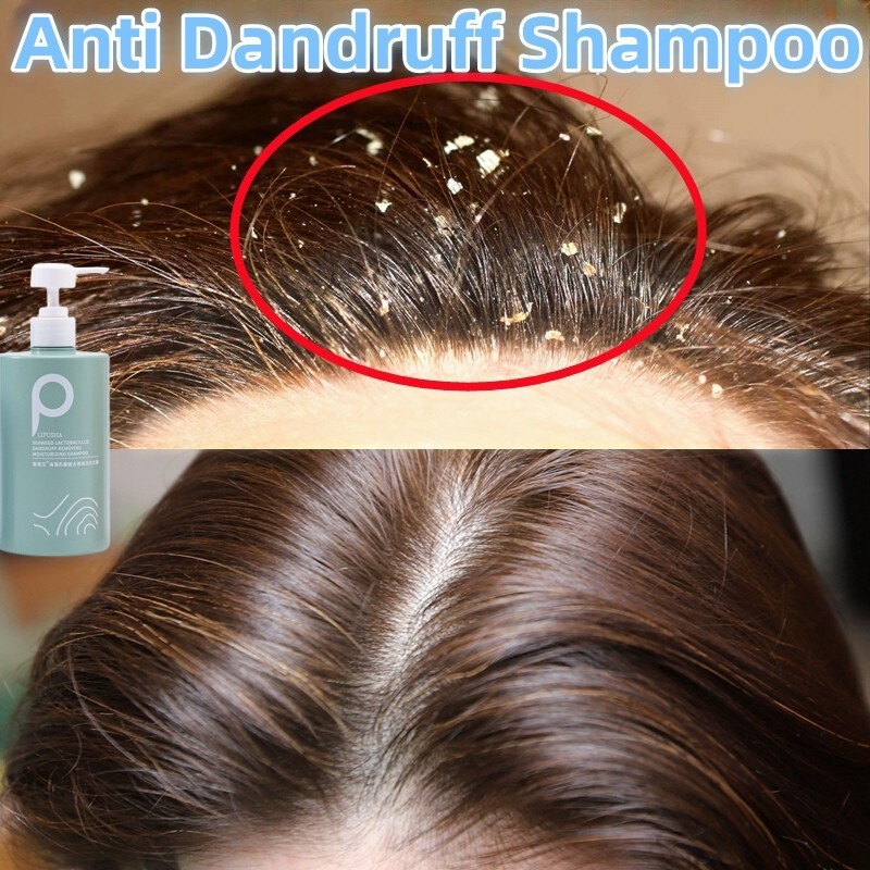 Sea Salt Anti Dandruff Refreshing Oil Control shampoo dandruff ...