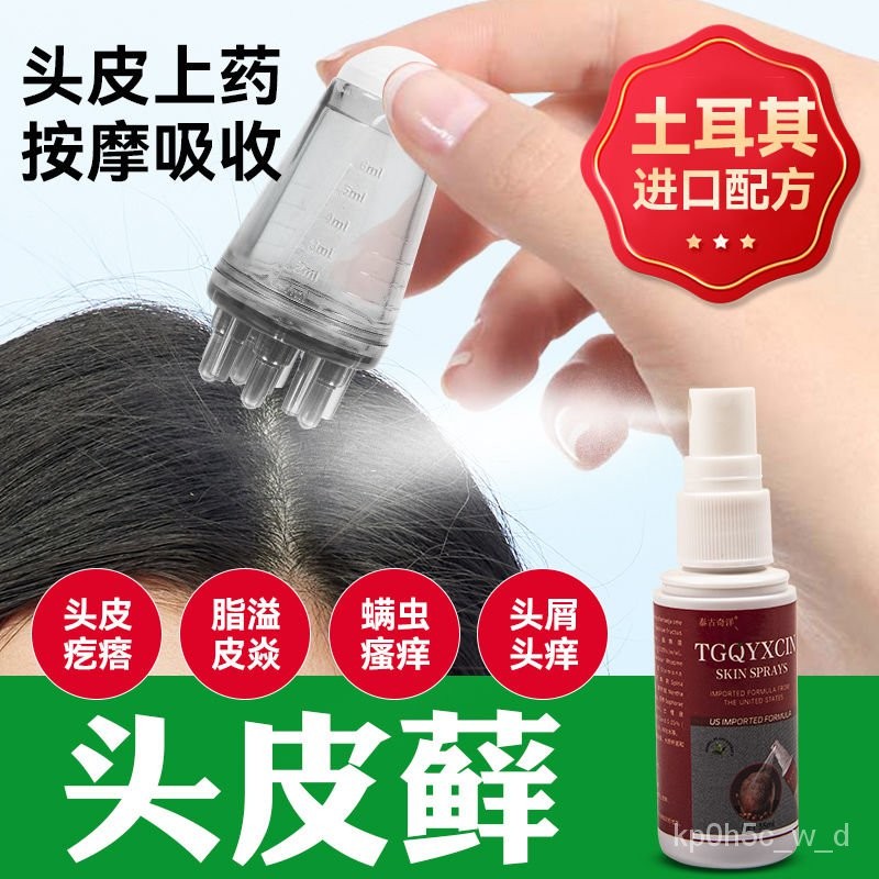 (Hot Sale)Imported Formula Tinea Capitis Scalp Itching Red Swelling ...