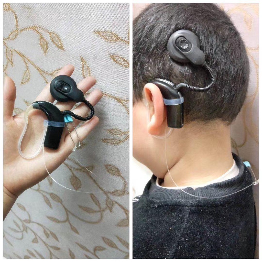 Cochlear anti-lost lock/fix the cochlea/prevent cochlea from falling ...