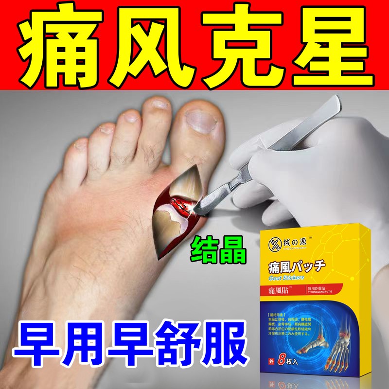 KY@ MechanicalのSource Gout Stickers Teke Effect Star Uric Acid Reducing ...