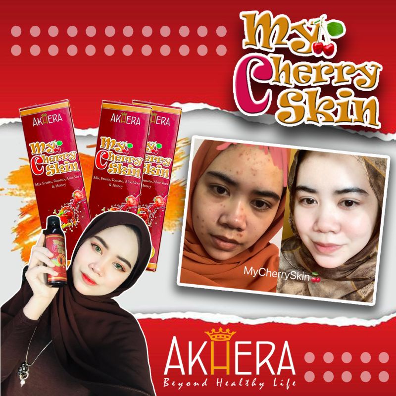 MY CHERRY SKIN 3 BOX WHITENING SUPPLEMENT [KESAN SEAWAL 7 HARI ...
