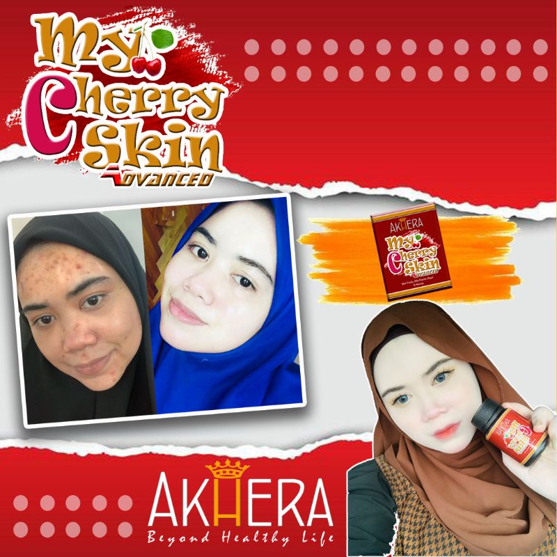 MY CHERRY SKIN ADVANCED WHITENING SUPPLEMENT [KESAN SEAWAL 7 HARI ...