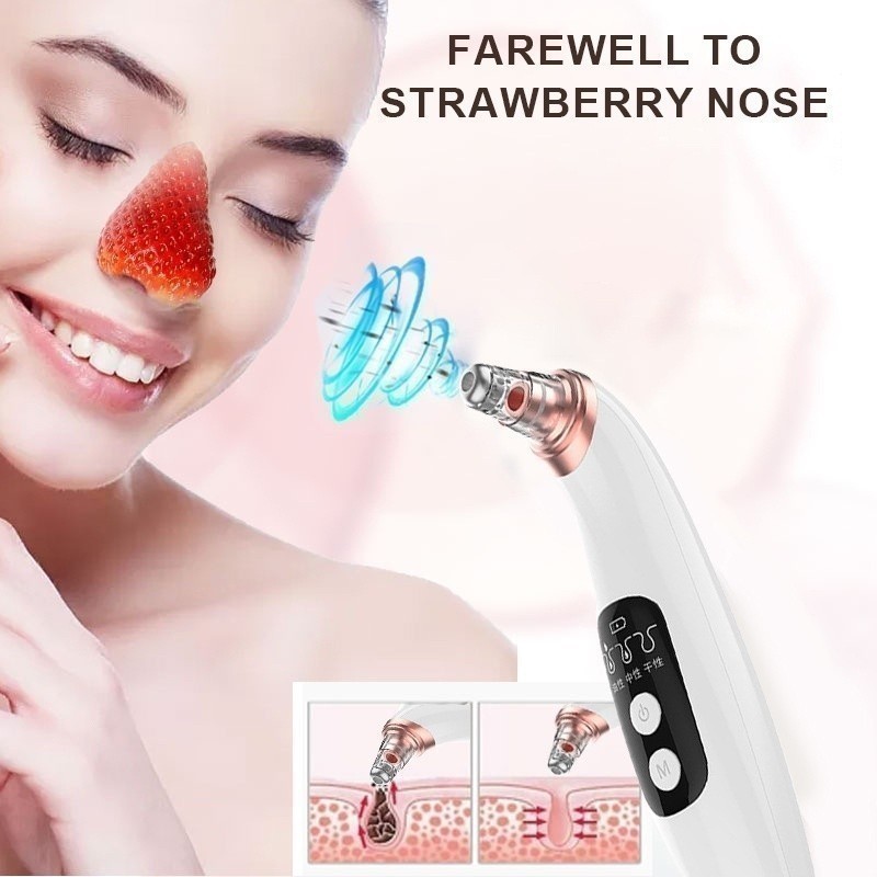 Blackhead Remover Facial Skin Cleanser Vacuum Suction Pore Clean ...