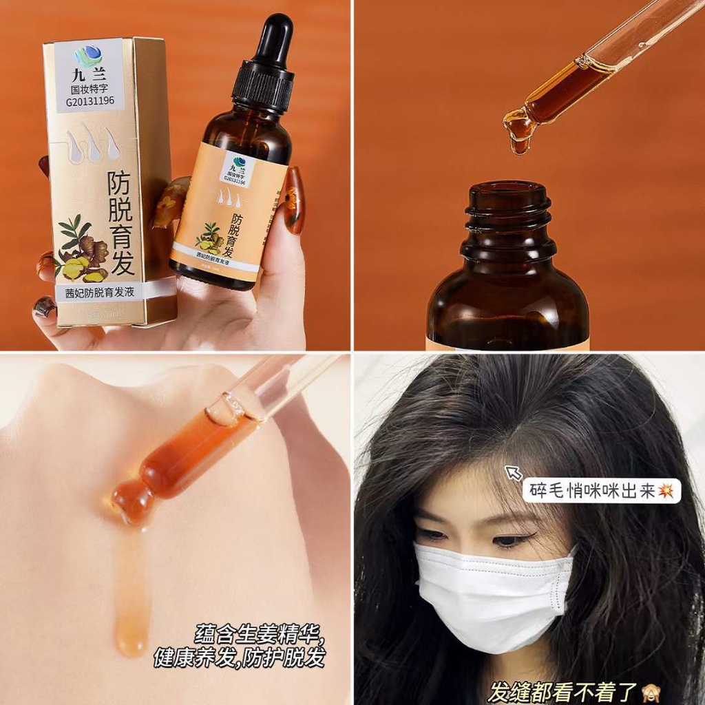 [Ready Stock] Jiulan Anti-Hair Loss Anti-Hair Loss Liquid Hair ...