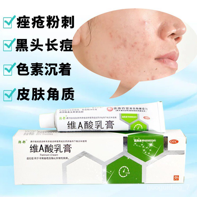 KY-JD DimensionAAcid Emulsifiable Paste15gAcne Cream Anti-Acne Impetigo ...